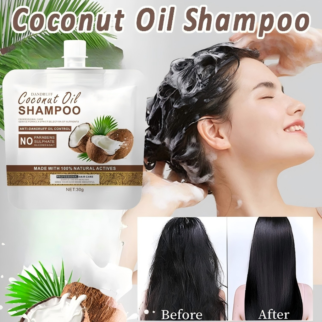 Anti Dandruff Shampoo Coconut Oil Shampoo for Scalp Itching Oil Control ...