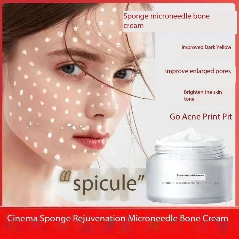 Sponge Bone Needle Cream Beauty Salon Dedicated Remove Yellow Acne ...