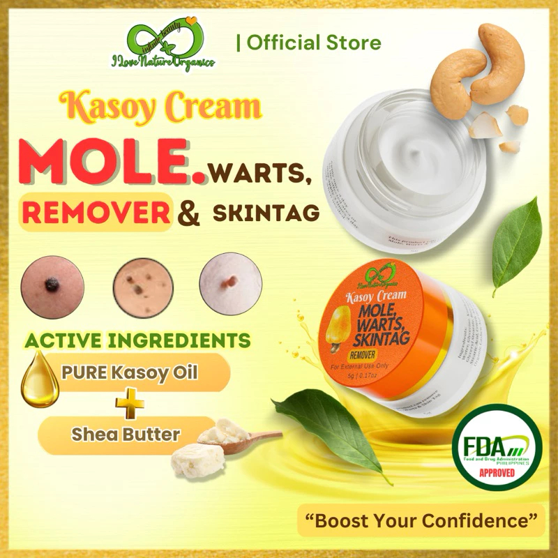 Kasoy Cream Mole Remover Warts Remover Skin Tags Remover | I Love ...