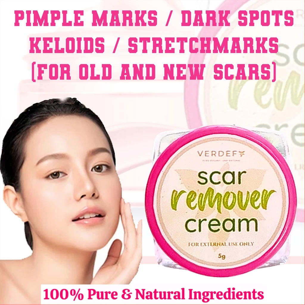 PEKLAT/SCAR REMOVER CREAM SKIN CARE REMOVE YOUR OLD AND NEW SCARS Acne ...