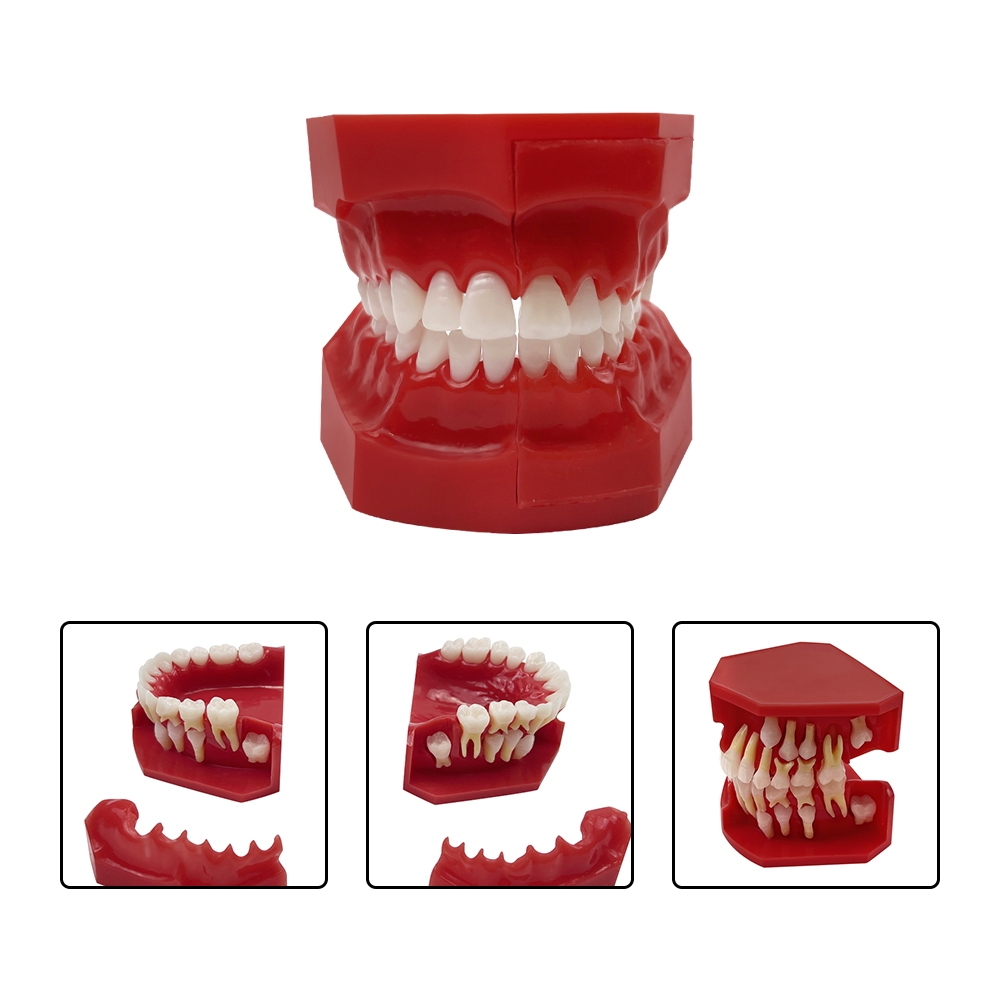 Removable Children Primary Permanent Tooth Mix Age Model For Studying ...