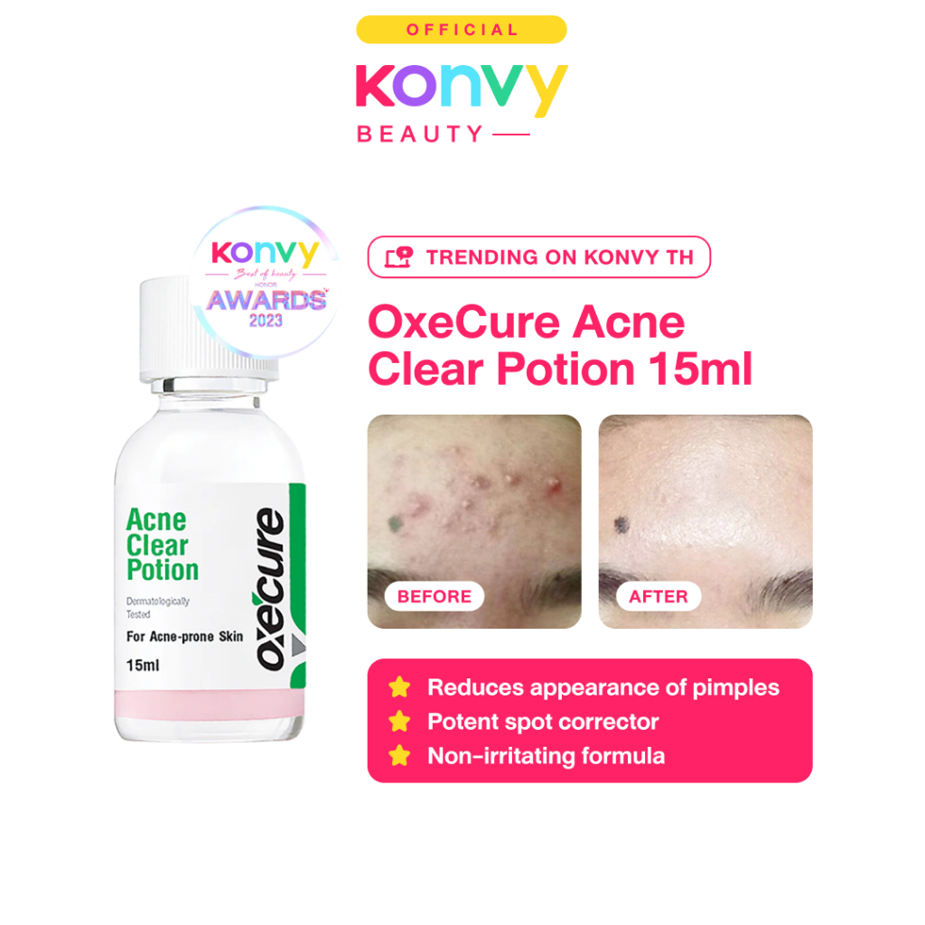 OxeCure Acne Clear Potion 15ml (For Acne-Prone Skin; Pimples ...