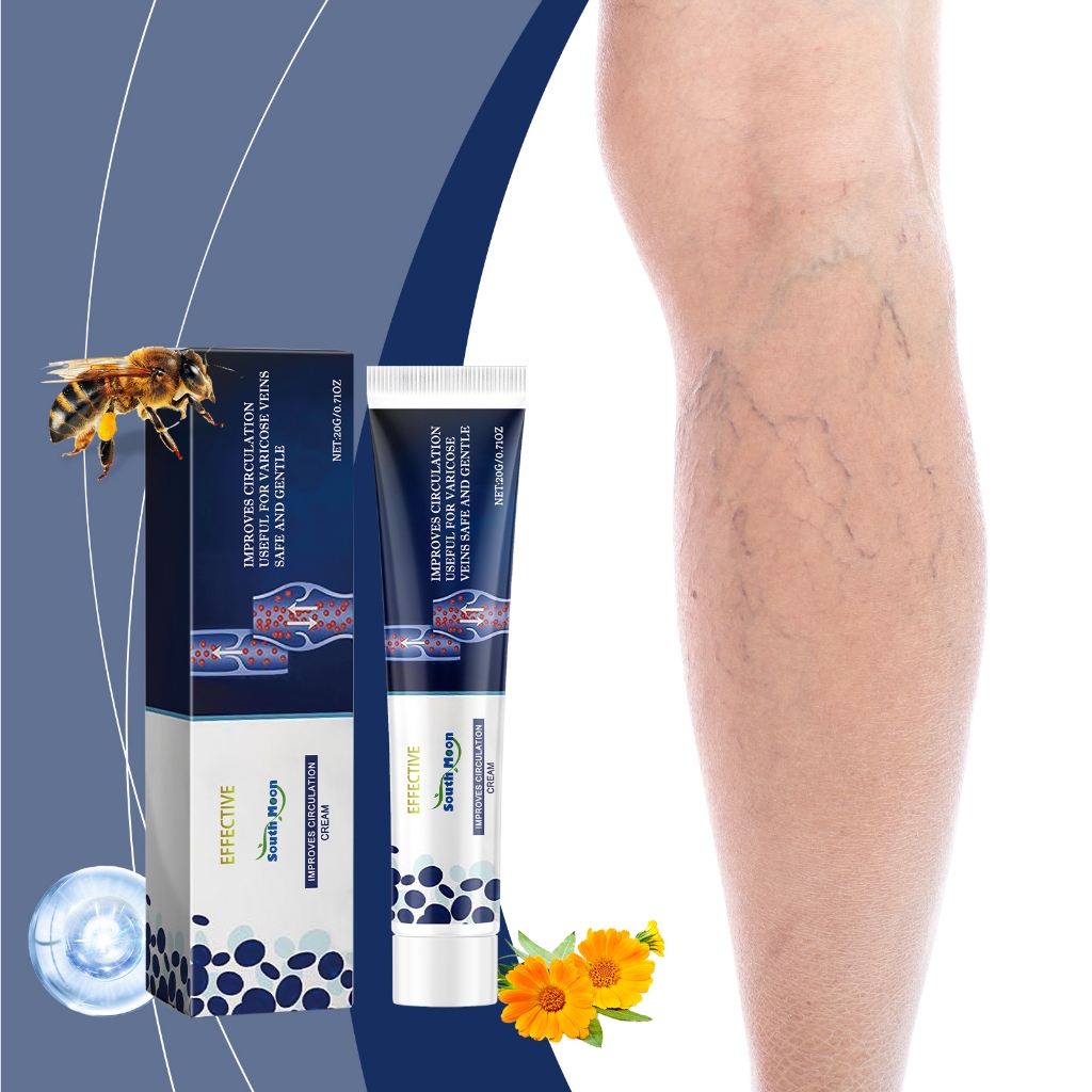 South Moon Varicose Veins Cream Soothe Leg Swelling Eliminate ...