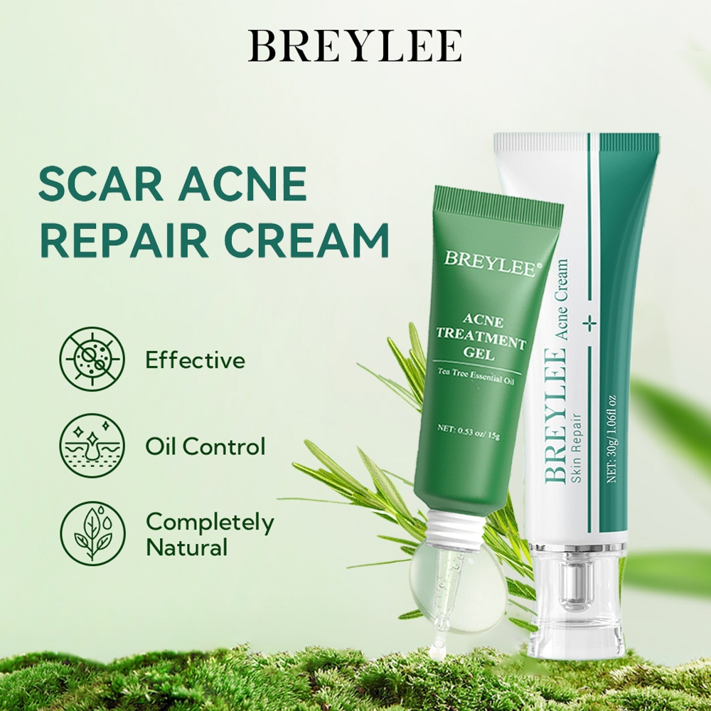 BREYLEE Acne Scar Repair Ceam Acne Treatment Gel Scar Fading Scar Acne Removal Fade Stretch ...