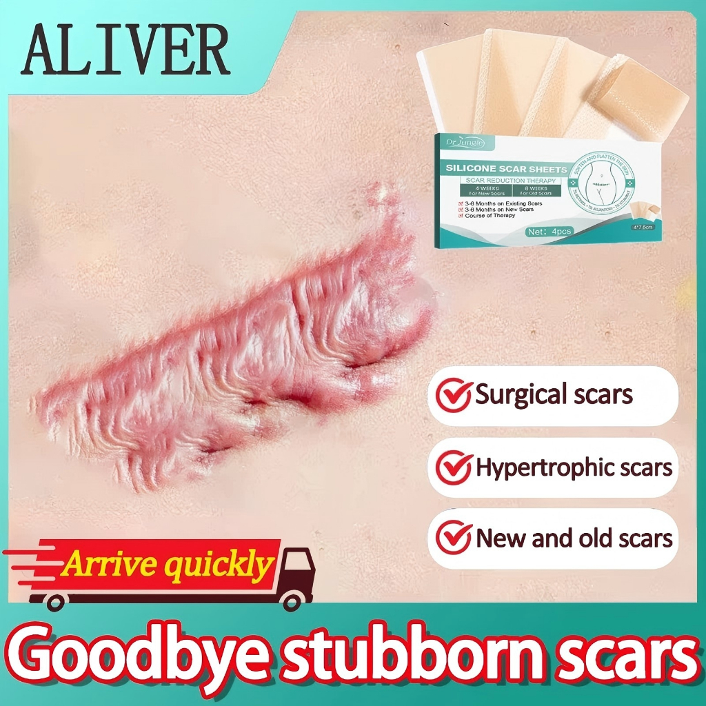 【Local delivery】Silicone Scar Removal Patch - Effective for Acne Scars ...