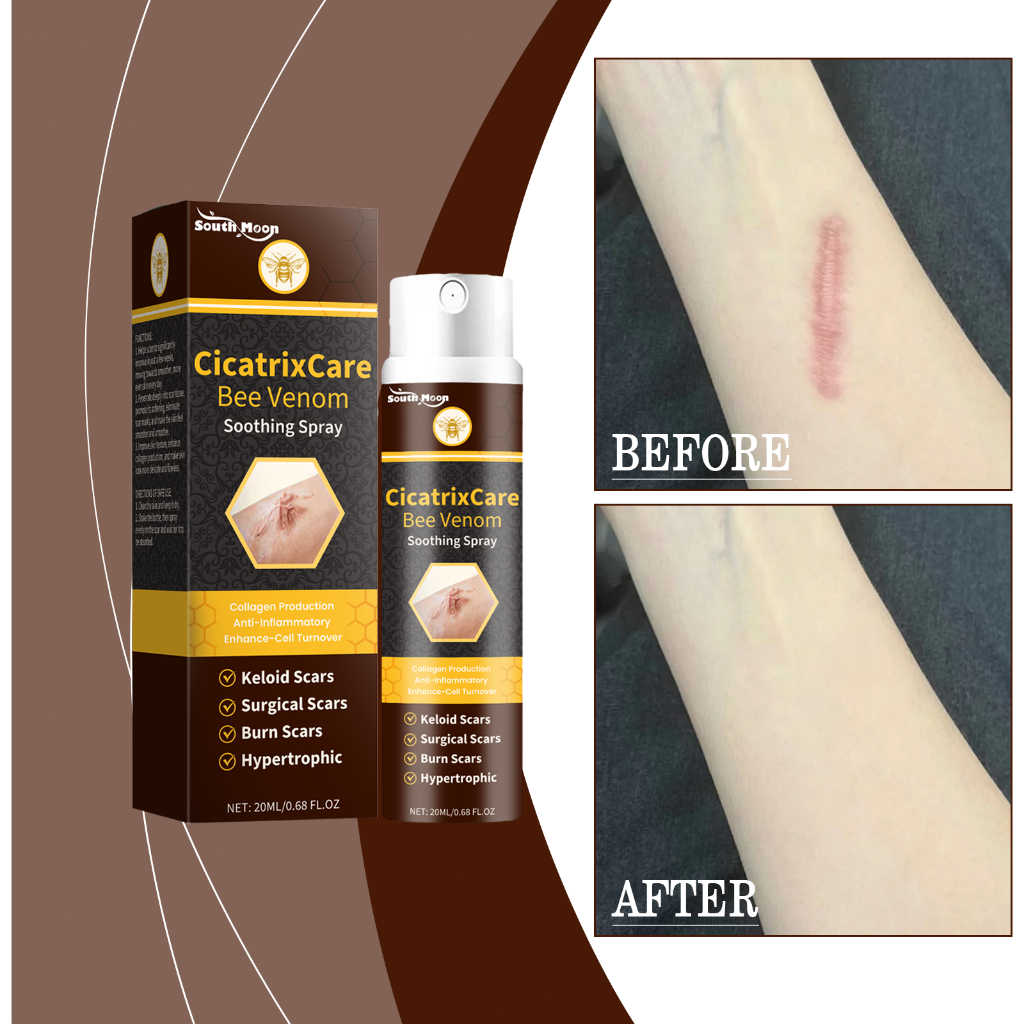 South Moon Scar Removal Spray Fade Stretch Marks Heal Surgical Burn ...