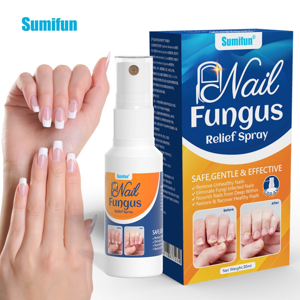 30ml Nail Fungal Relief Spray Treatment Essential Anti Fungals ...