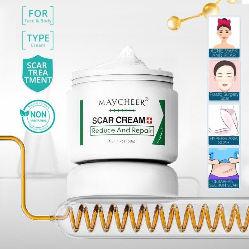 Maycheer Acne Scar Remover Old Scar Scarminator Cream Strech Mark ...