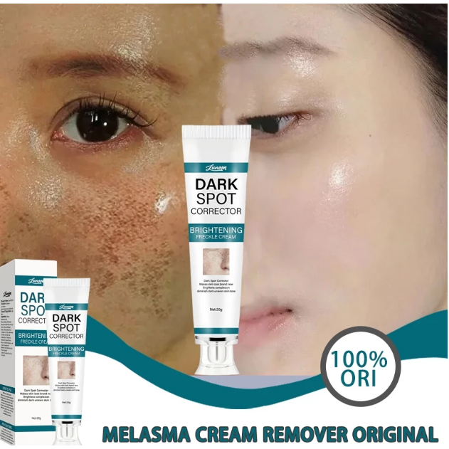 Melasma cream pekas remover Original Collagen pekas cream remover ...
