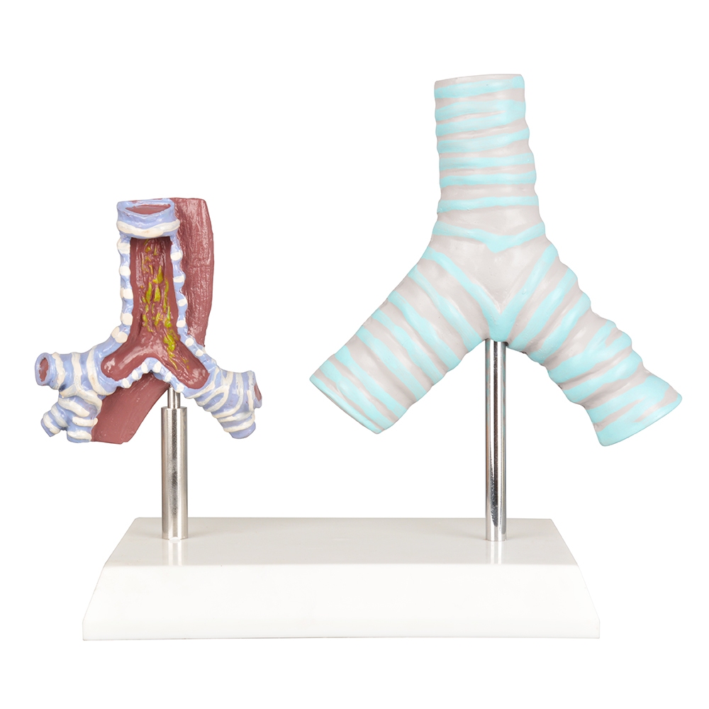Desktop Model Comparing Healthy and Smoker’s Trachea | Shopee Philippines