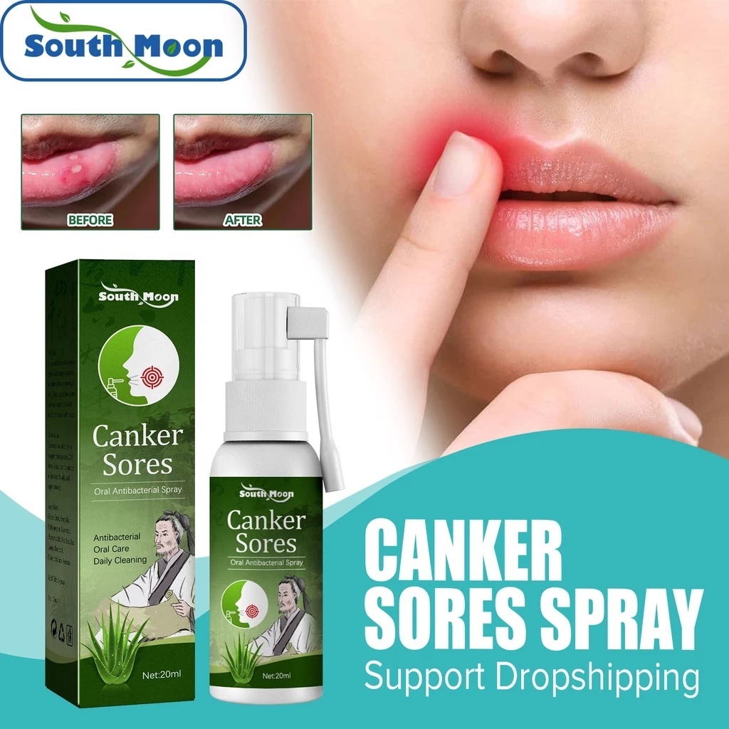 South Moon 20ML Oral Ulcer Spray Treatment Pharyngitis Halitosis Sore ...