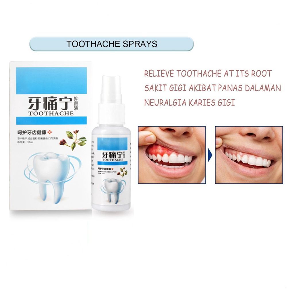 Toothache Treatment Spray Relieves Periodontitis Tooth Decay Pains ...