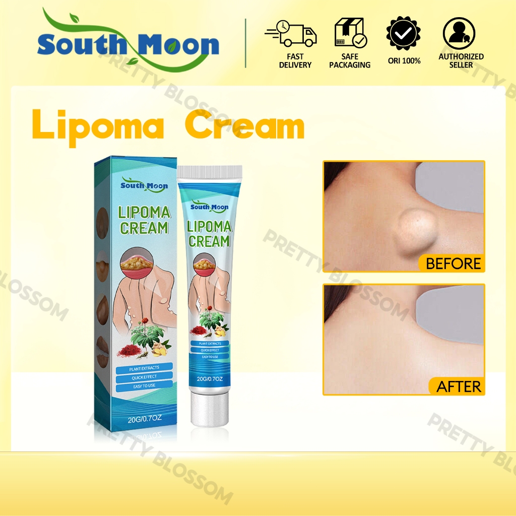 South Moon 20g Lipoma Removal Cream Lipolysis Fat Lump Relief Plaster ...