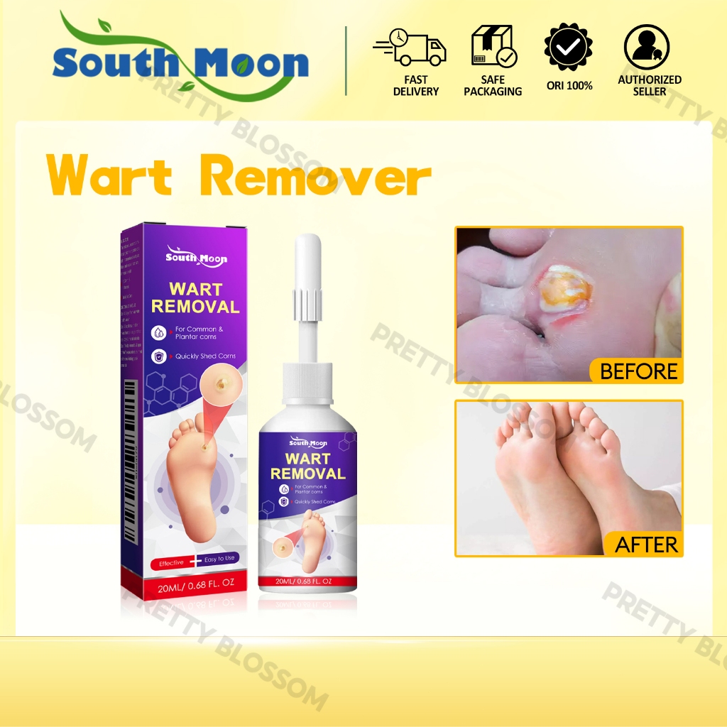 【BUY 2 GET 1 Gift】South Moon Wart Remover Cream 20ml Skin Tag Remover ...