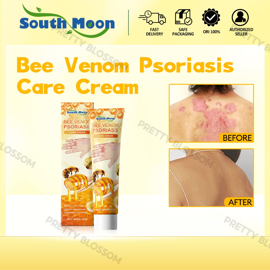 South Moon Bee Venom Psoriasis Relieve Ointment Urticaria Eczema ...