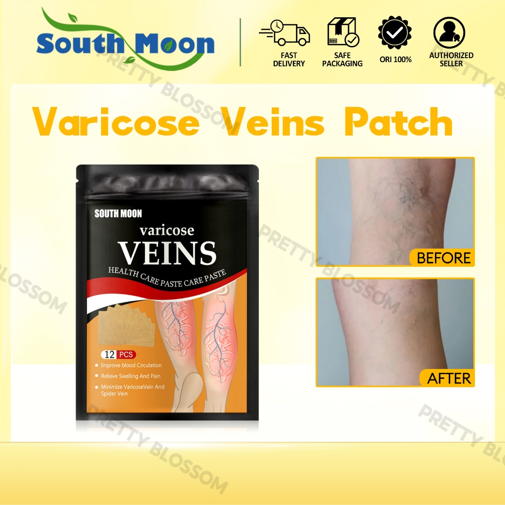 South Moon Foot Vein Health Patch Relieves varicose vein blockage and ...