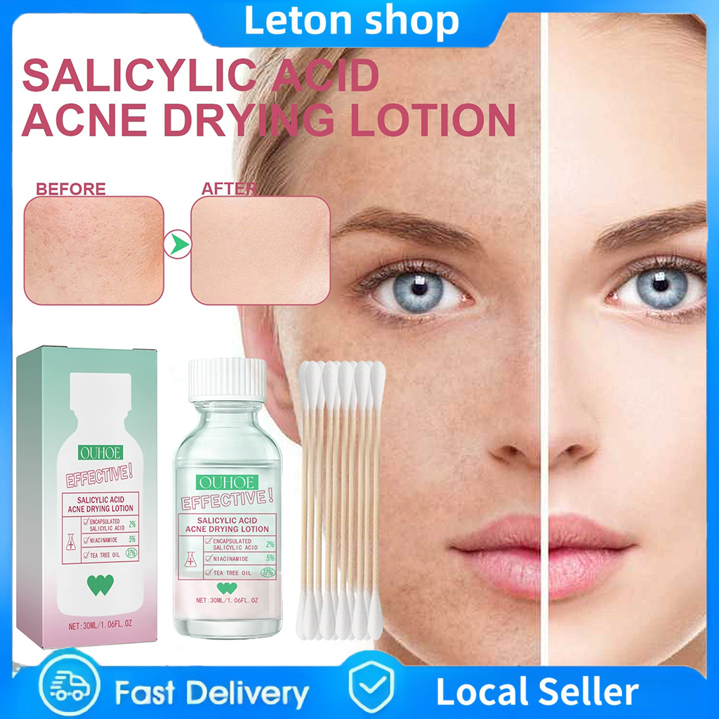 Ouhoe Salicylic Acid Acne Drying Lotion Gently Repair Acne-Prone ...