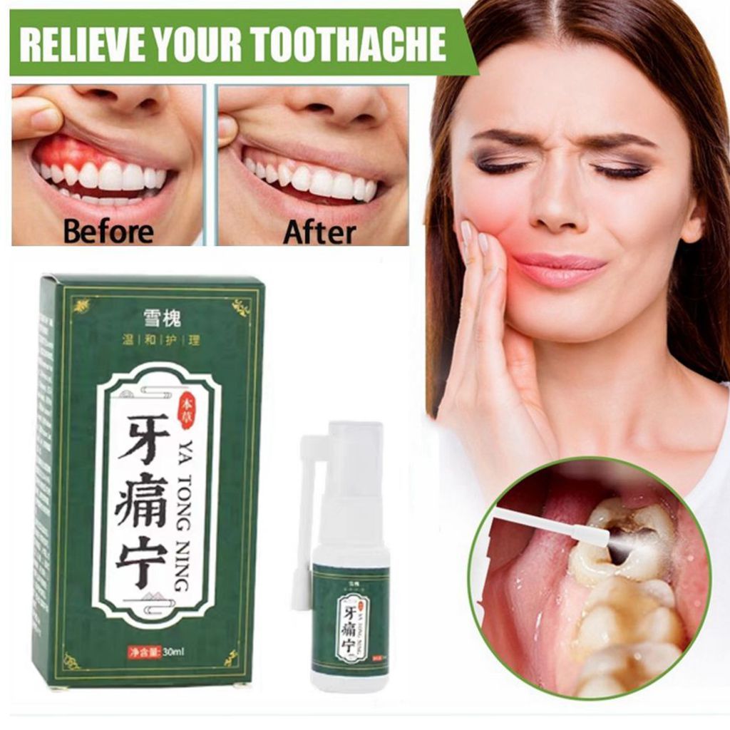 Toothache Treatment Spray Relieves Periodontitis Tooth Decay Pains ...