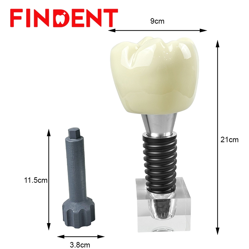 1Pcs Large Single Dental Implant Model Demonstration Dentistry ...