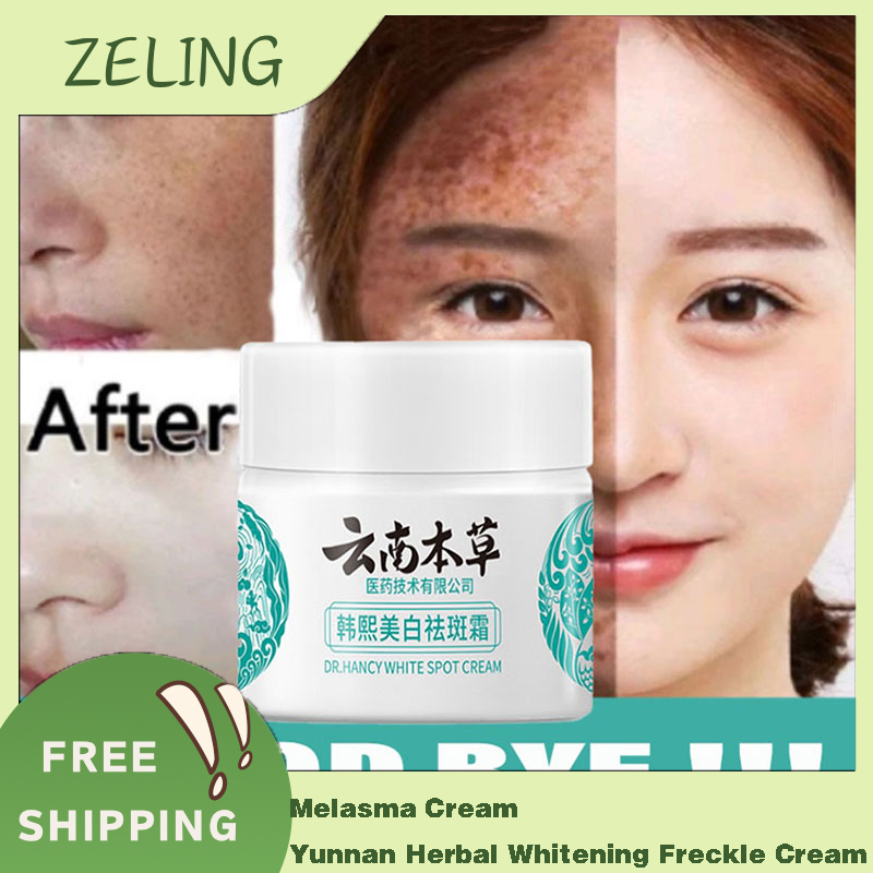 Melasma Cream Yunnan Herbal Whitening Freckle Cream Melasma Cream ...