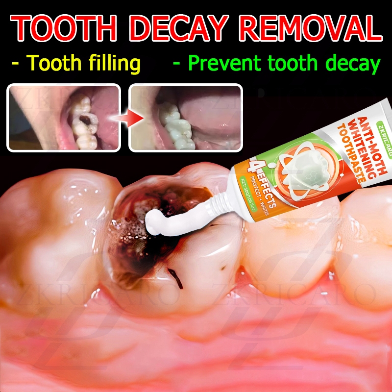 Anti-cavity toothpaste Fill cavities Prevent cavities Protect teeth and ...