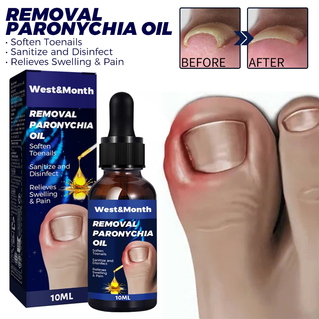 10ml Anti Paronychia Relief Oil Ingrown Toenail Anti Fungal Toe Nail ...