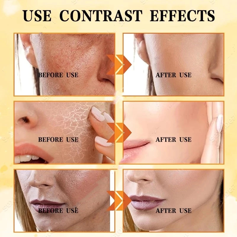 500ML Vitamin C Toner Intensive Whitening Toner Essence Remove Melasma Acne Pimple Marks Skin ...