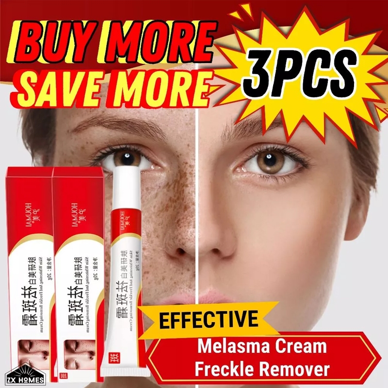Buy 1 get 1 Anti-freckle Cream Melasma Cream Collagen anti-freckle ...