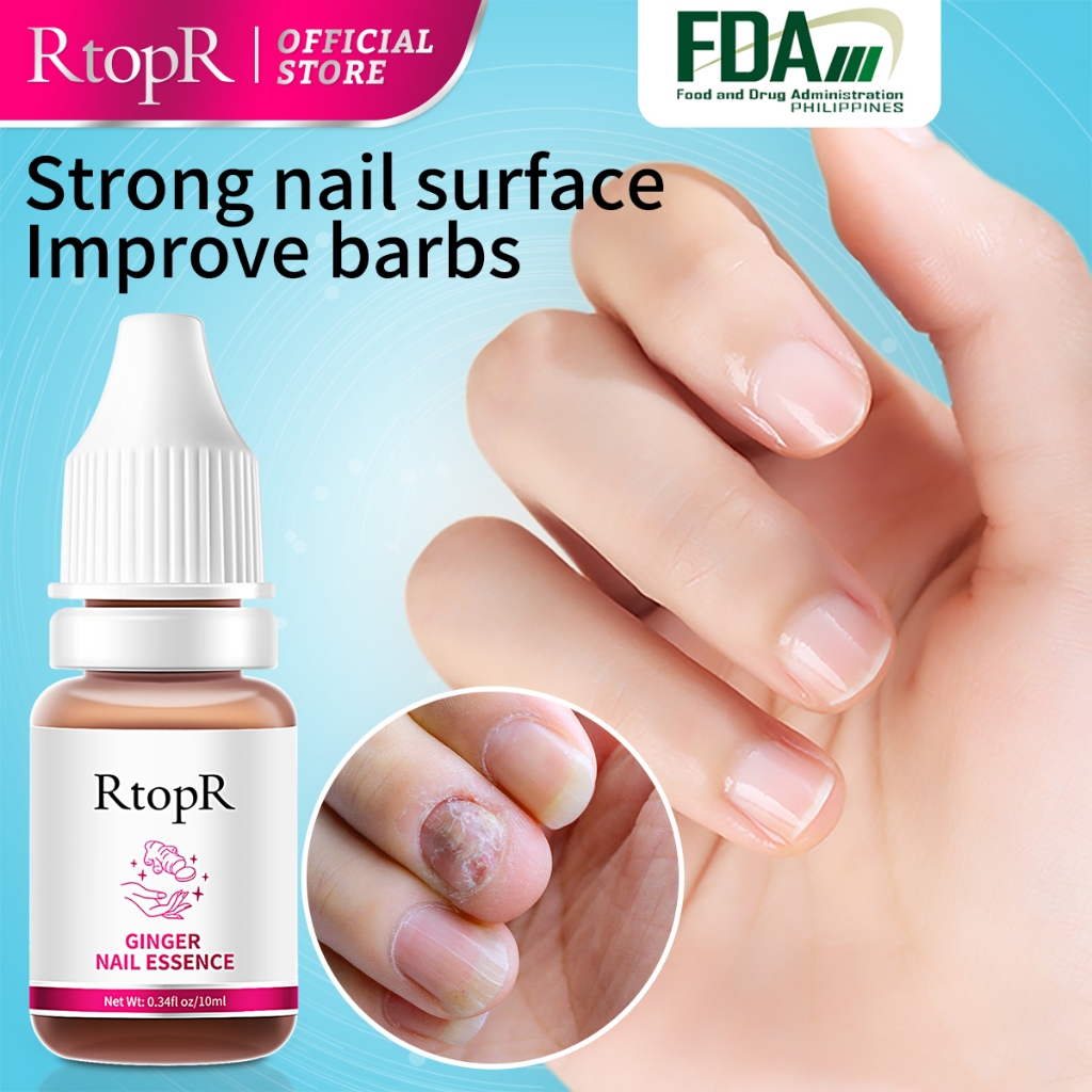 RtopR FDA 10% Zingiber Officinaleginger Ginger Antibacterial Nail ...