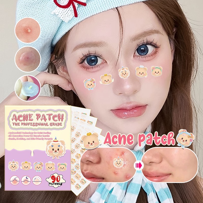 Butter Bear-Themed Waterproof Acne Patch - 90 Pimple Spot Stickers with ...