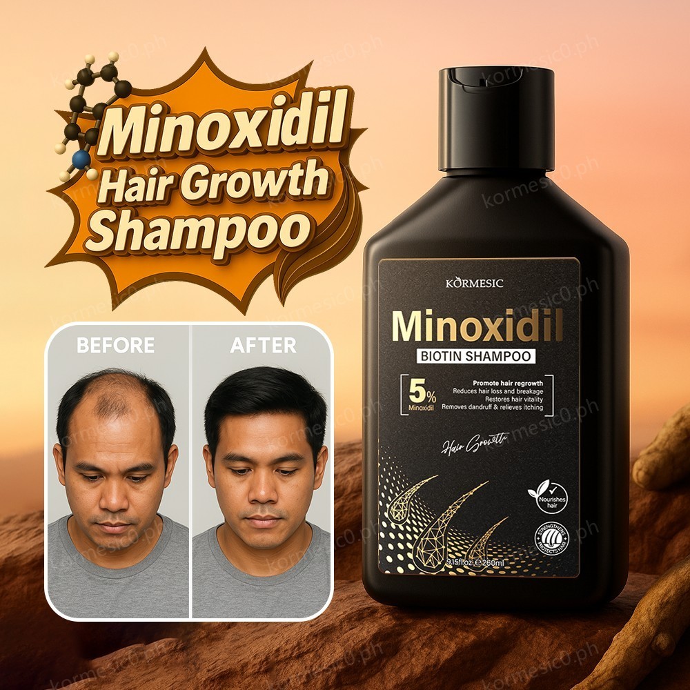 KORMESIC 5% Minoxidil+Biotin Shampoo 260ml - DHT Blocker Anti-Hairloss ...