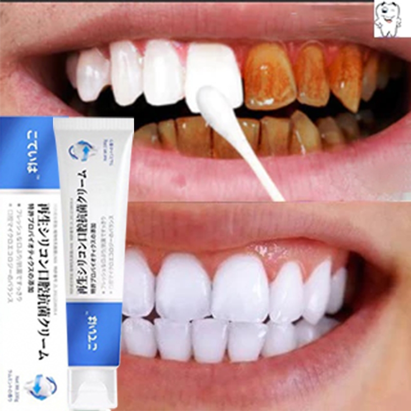 Japanese toothpaste whitening teeth 100g Tartar removal for teeth Teeth ...