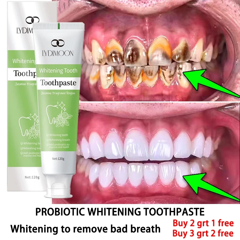 toothpaste whitening teeth Probiotic Whitening Toothpaste dental care ...