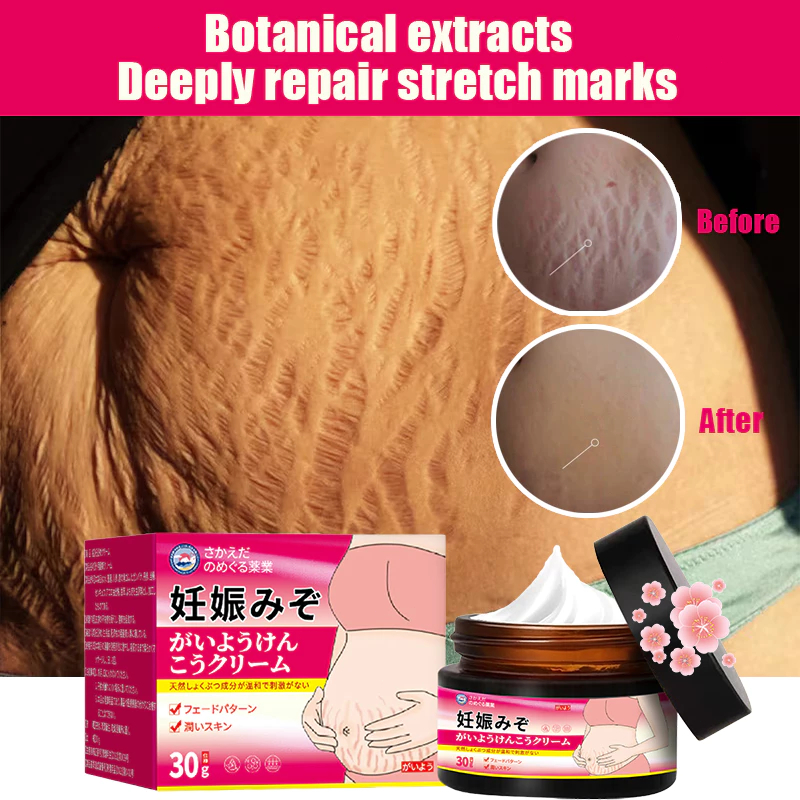 Stretch mark remover original anti stretch mark cream strech mark ...