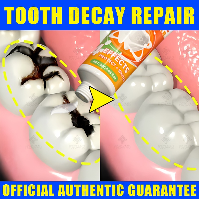 Whitening teeth toothpaste anti bad breath toothpaste anti tooth decay ...