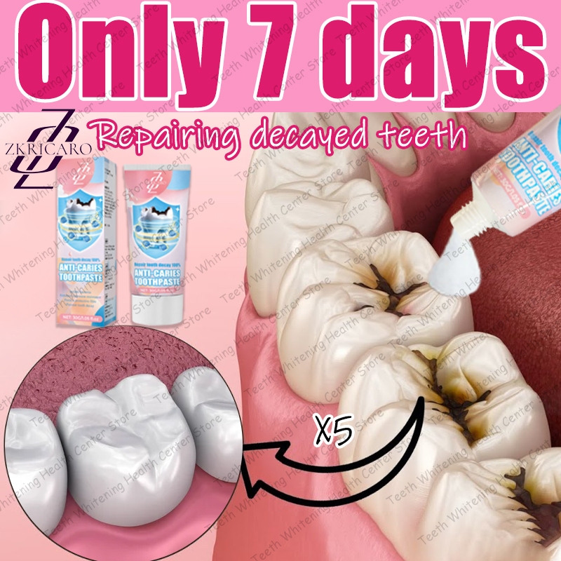 Quickly Repair Toothpaste Of Cavities Caries Whitening To Remove Plaque ...
