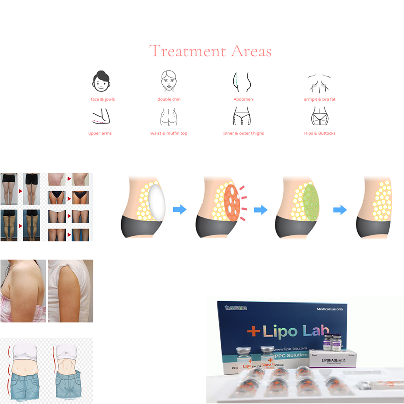 Weight Freeze-Dried Powder lipo Korea PCC Body Essence lab Management ...