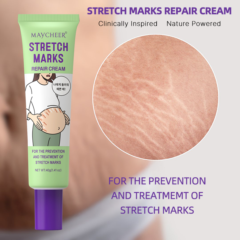 Stretch Marks Remover for Pregnancy Postpartum Care Anti Wrinkle Skin ...