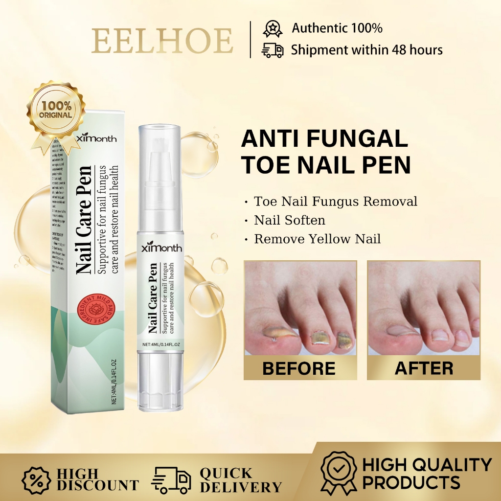 Anti Fungal Toe Nail Pen Onychomycosis Treatment Serum Nail Fungal ...