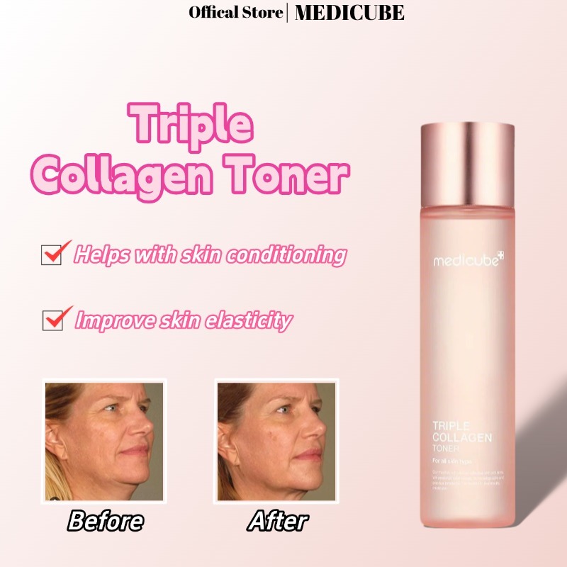 Medicube Triple Collagen Toner 140ml Hydrolyzed, Atelo | Shopee Philippines
