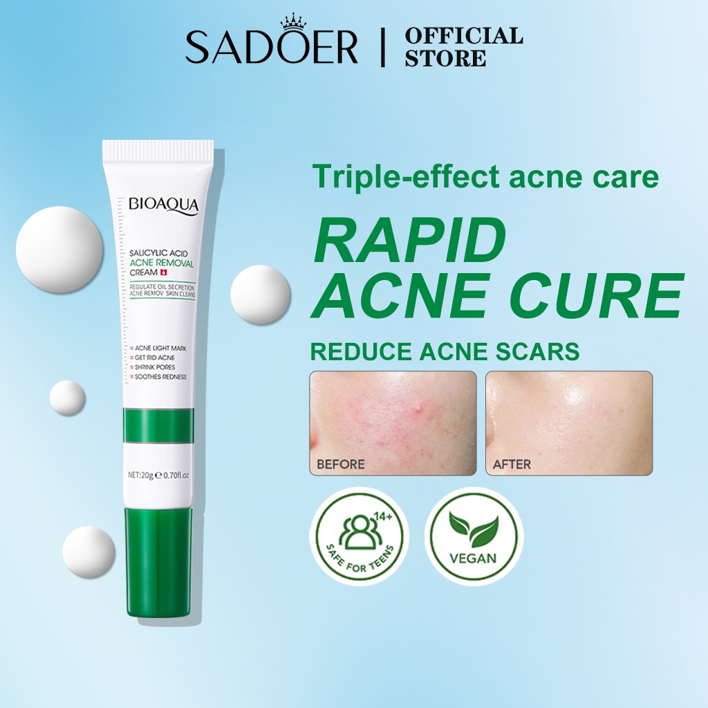 SADOER Salicylic Acid Acne Removal Cream Improve Acnes Blackheads Whitening Cream Anti-aging Oil ...