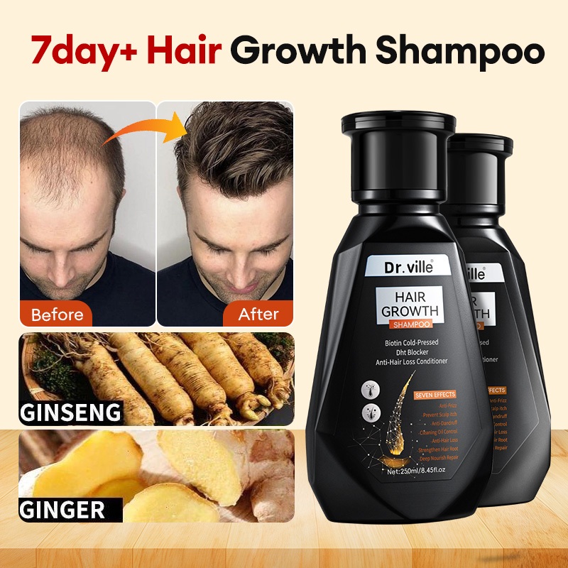Ginger Hair Grower Shampoo Promotes Hair Growth Anti-Hair Loss 250ml ...