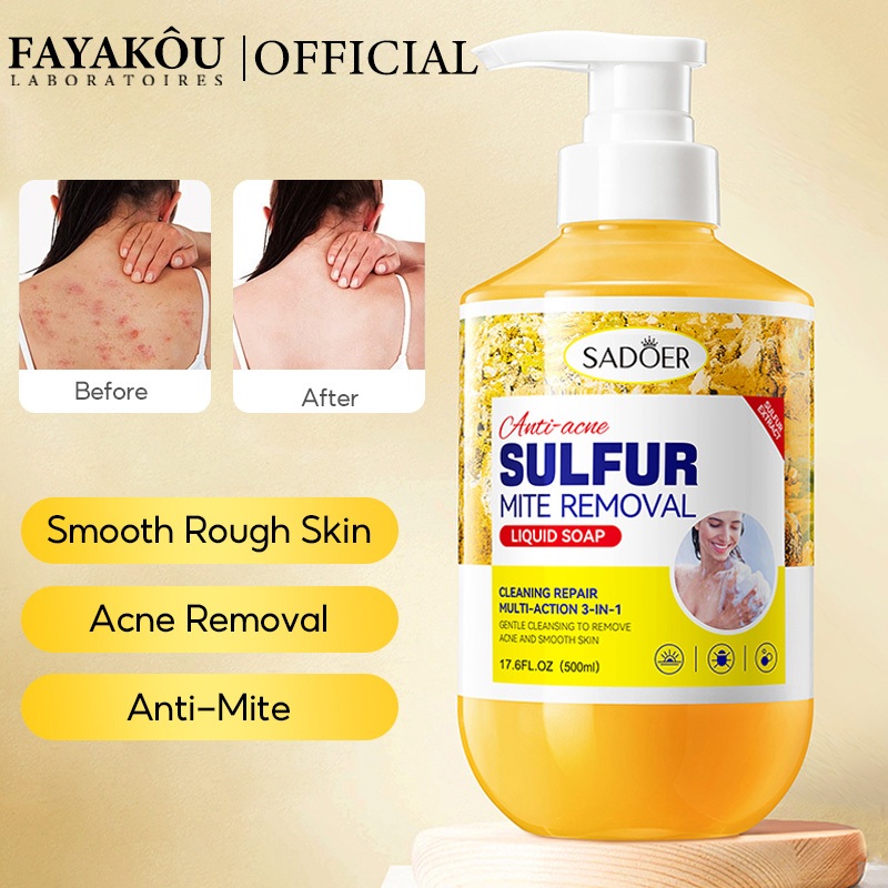 FAYANKOU Sulphur Mite Body Wash Anti acne Mite Remove Moisturizing ...