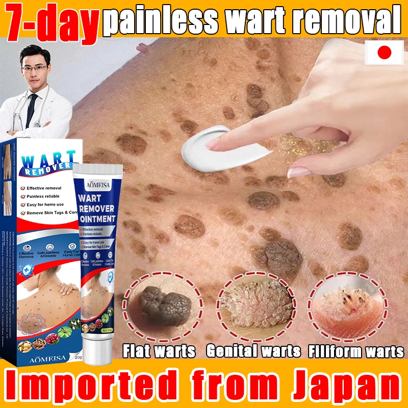 [Philippines Hot Seller] Original Wart Removal Cream - Effective, Fast ...