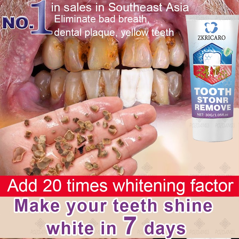 Quickly Repair Toothpaste Of Cavities Caries Whitening To Remove Plaque ...