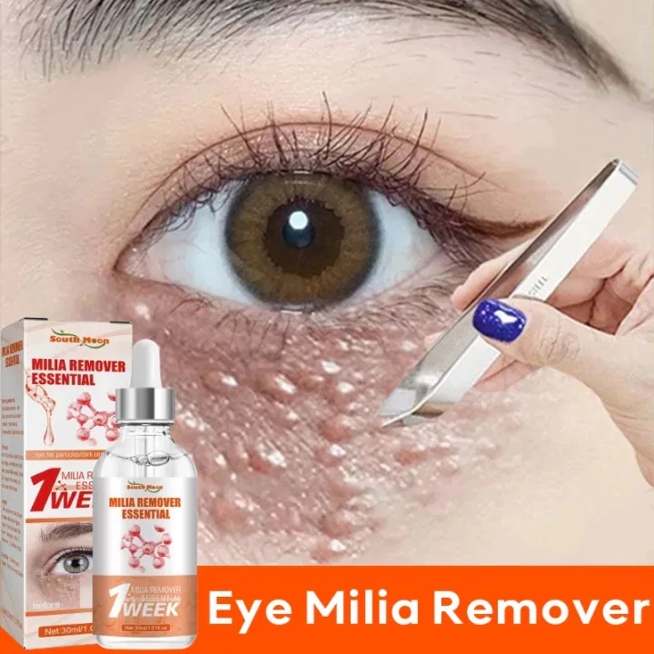Eye Milia Removal Cream 30ml Fat Granules Removal Eye Serum Eye Milia ...