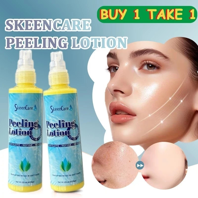 【BUY 1 TAKE 1】 100ml Lotion Renew Dead Skin For Face and Body SkeenCare ...