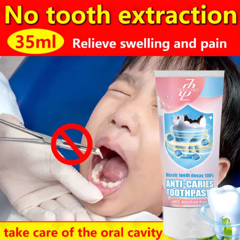 【Imported from Japan】Fluoride restorative toothpaste, suitable for both ...