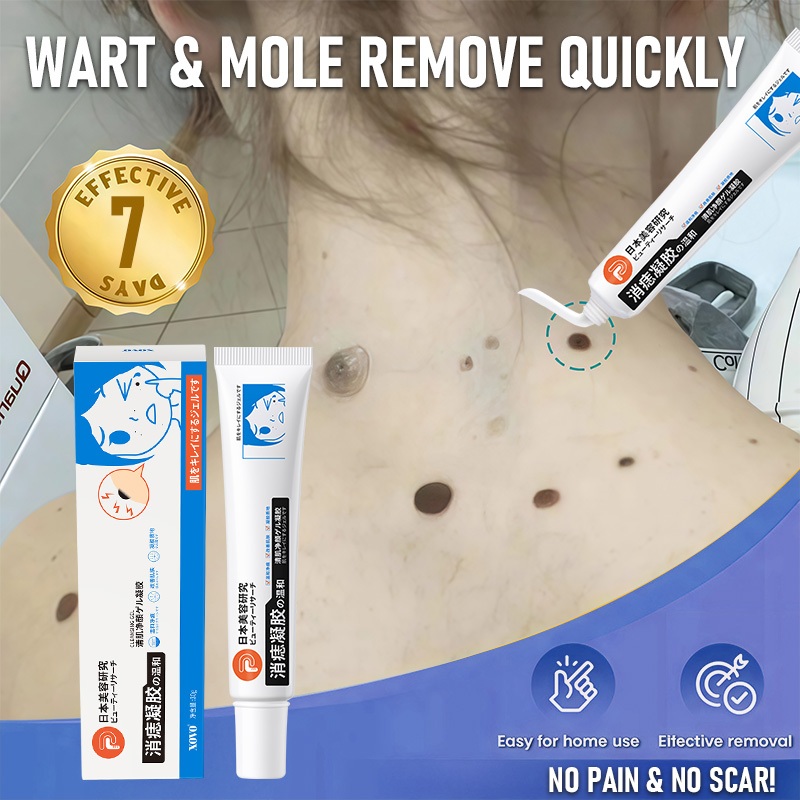 Warts Remover Gel 30g Warts Treatment Skin Tags Mole removal Dark Spot ...