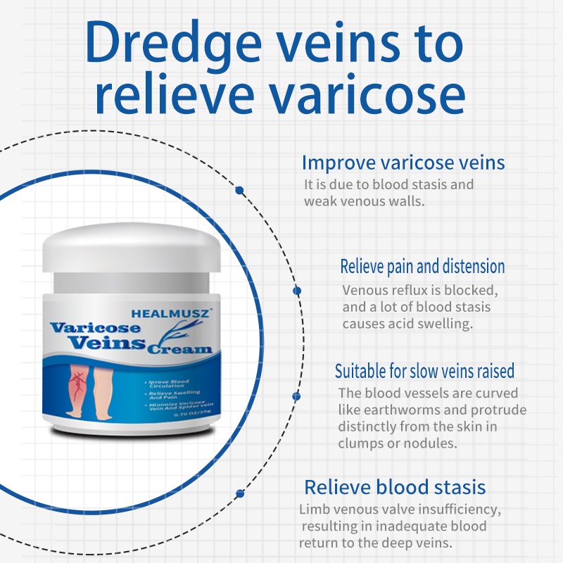 healmusz varicose veins cream Dredge veins amd lmprove to relieve ...